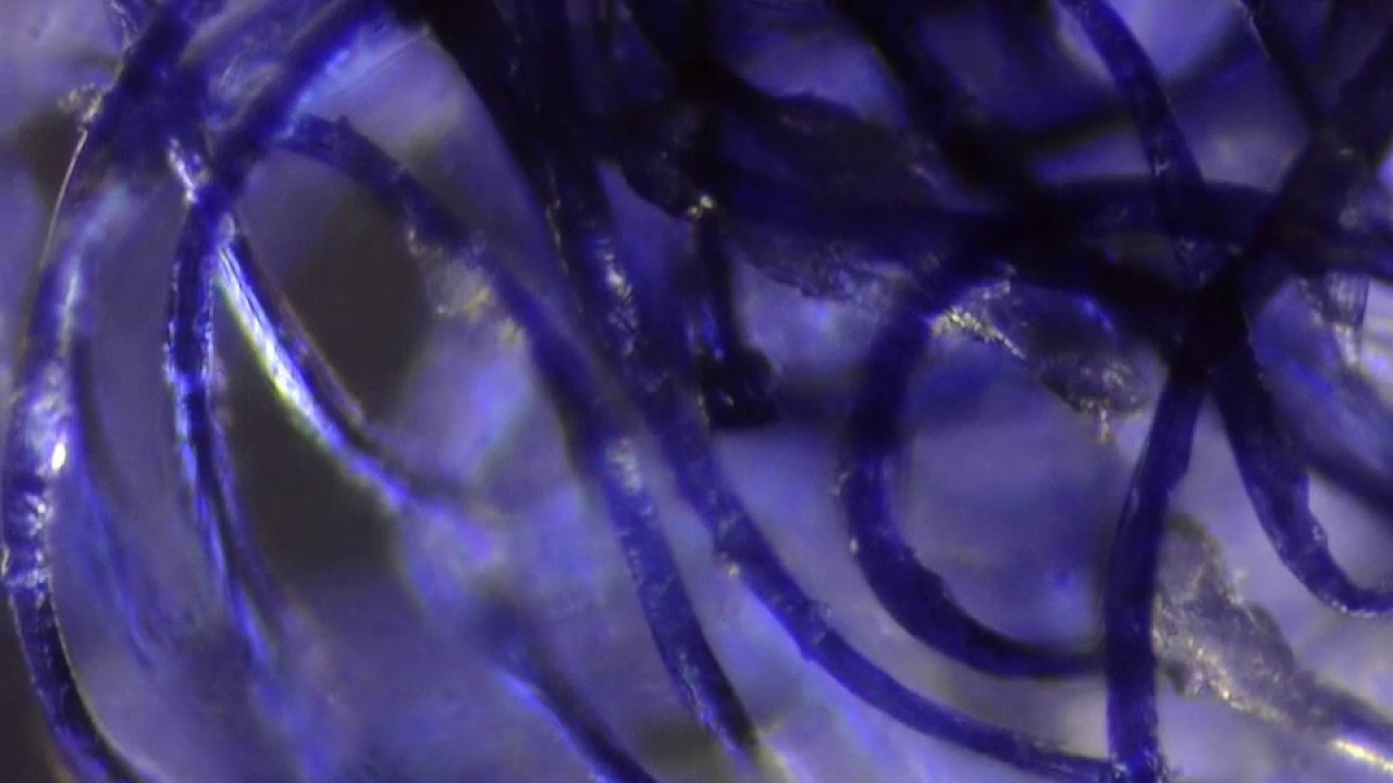 My Morgellons Symptoms - YouTube
