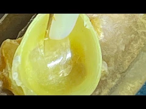 LARVA TRANSFERİ- ARIDA KALİTEDE PÜF NOKTALARI…