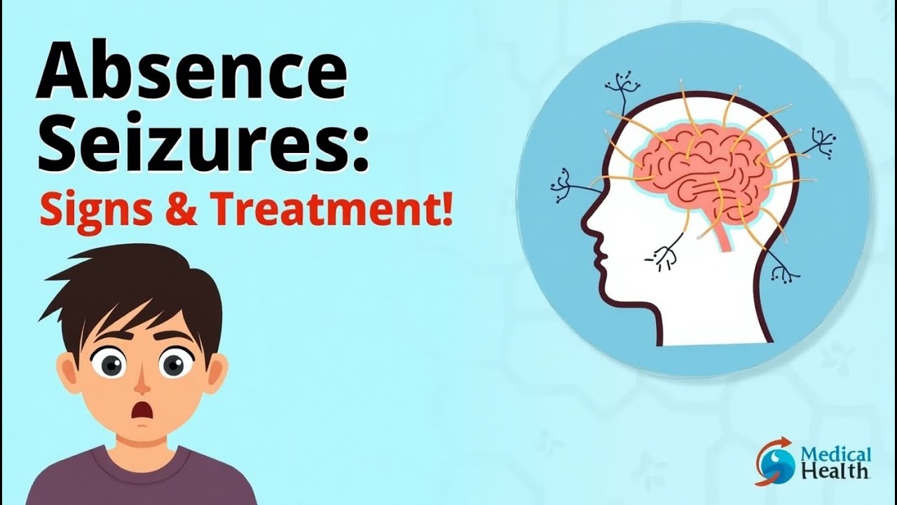 Absence Seizures Explained Symptoms, Causes & Treatment Options - YouTube