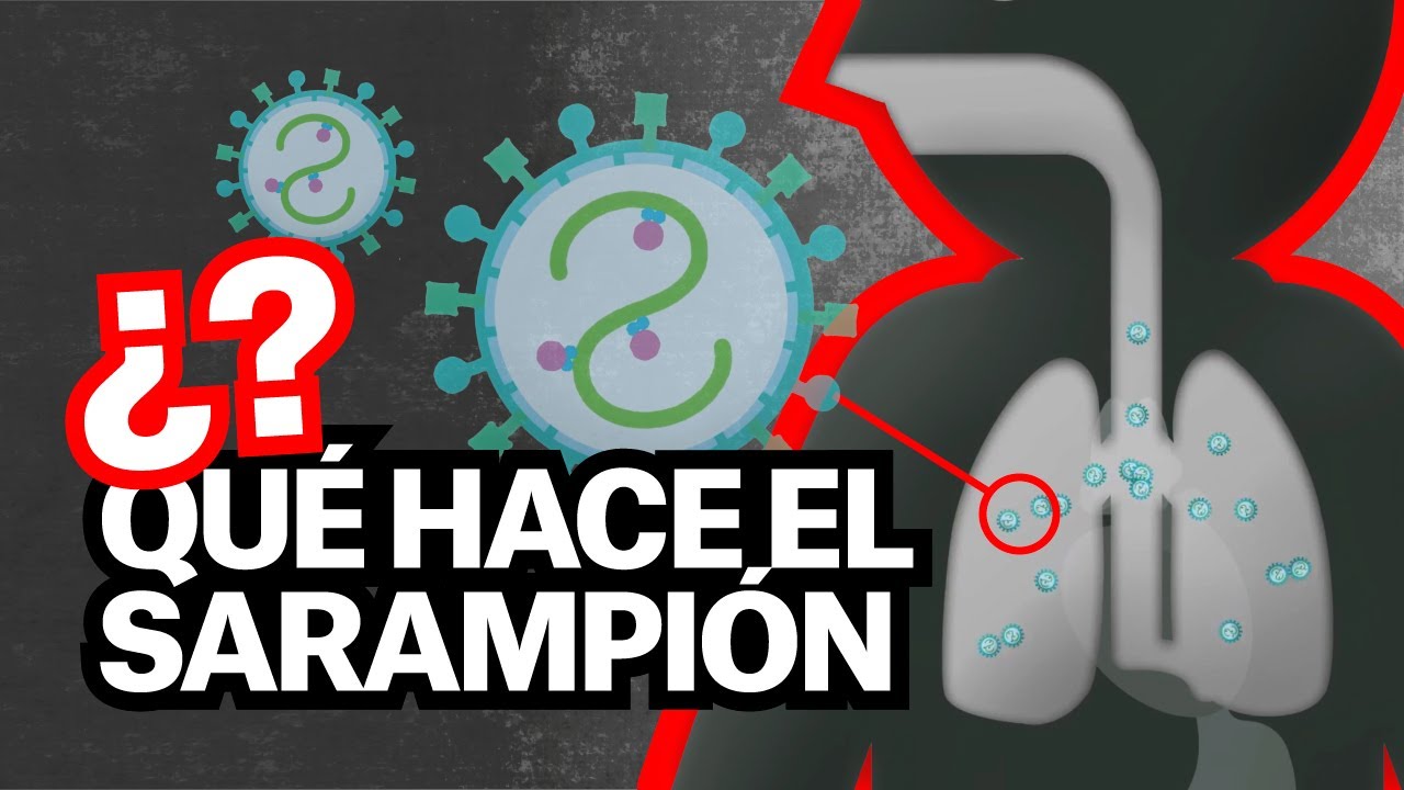 ¿Qué es el sarampión? ¿Cuáles son sus síntomas? ¿Cómo se contagia ...