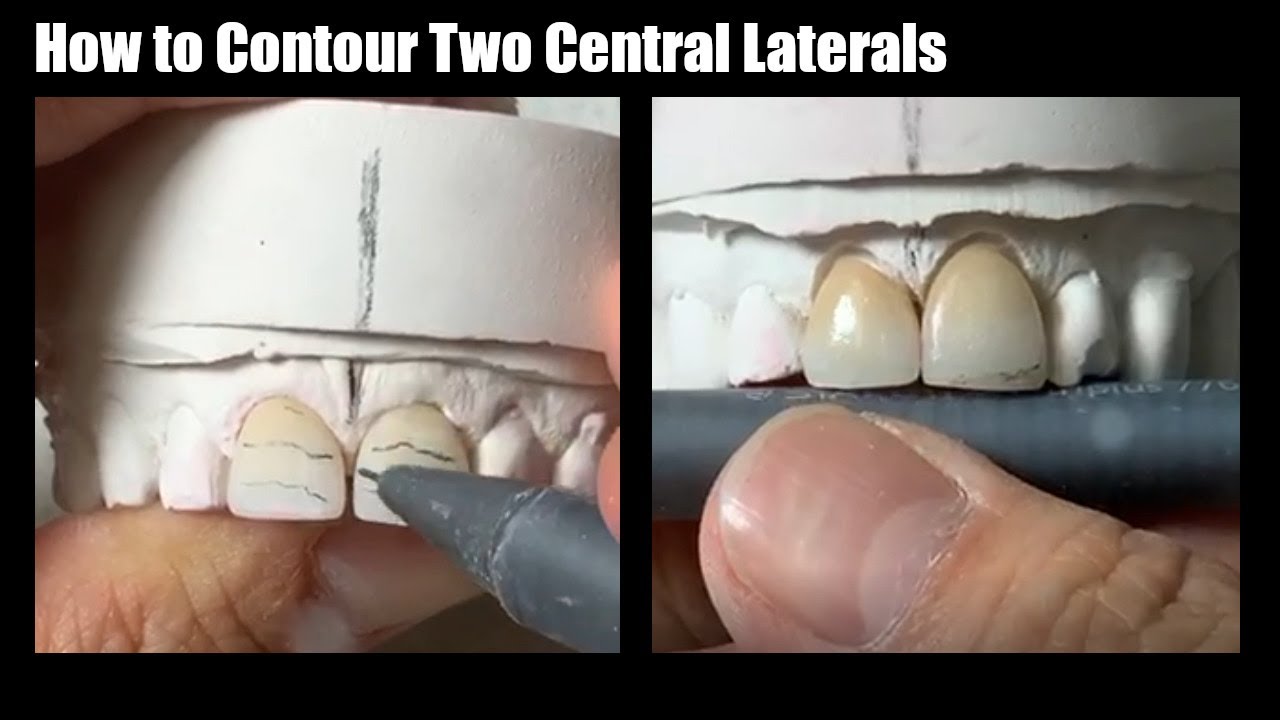 How to Contour Two Central Laterals - YouTube