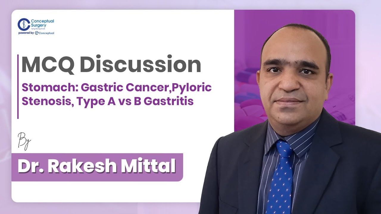 MCQ Discussions |Stomach: Gastric Cancer, Pyloric Stenosis, Gastritis ...