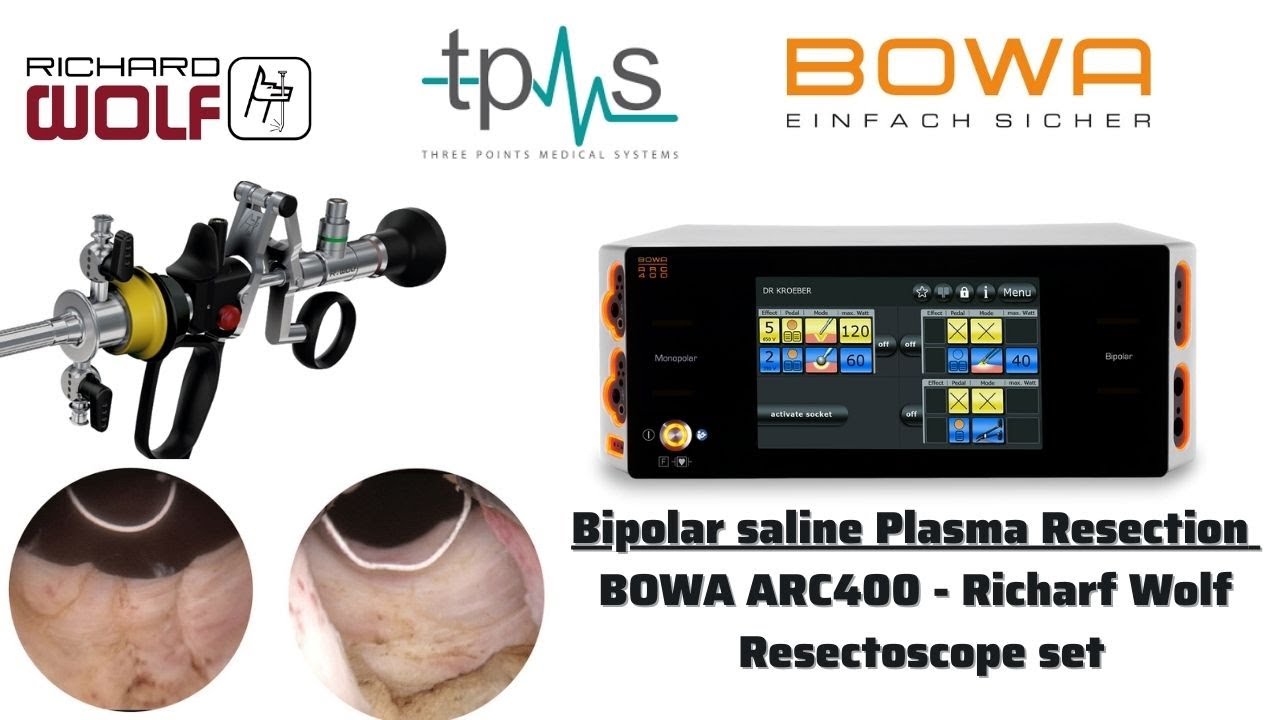 BOWA ARC 400 Bipolar Saline Plasma Resection with Richard Wolf ...