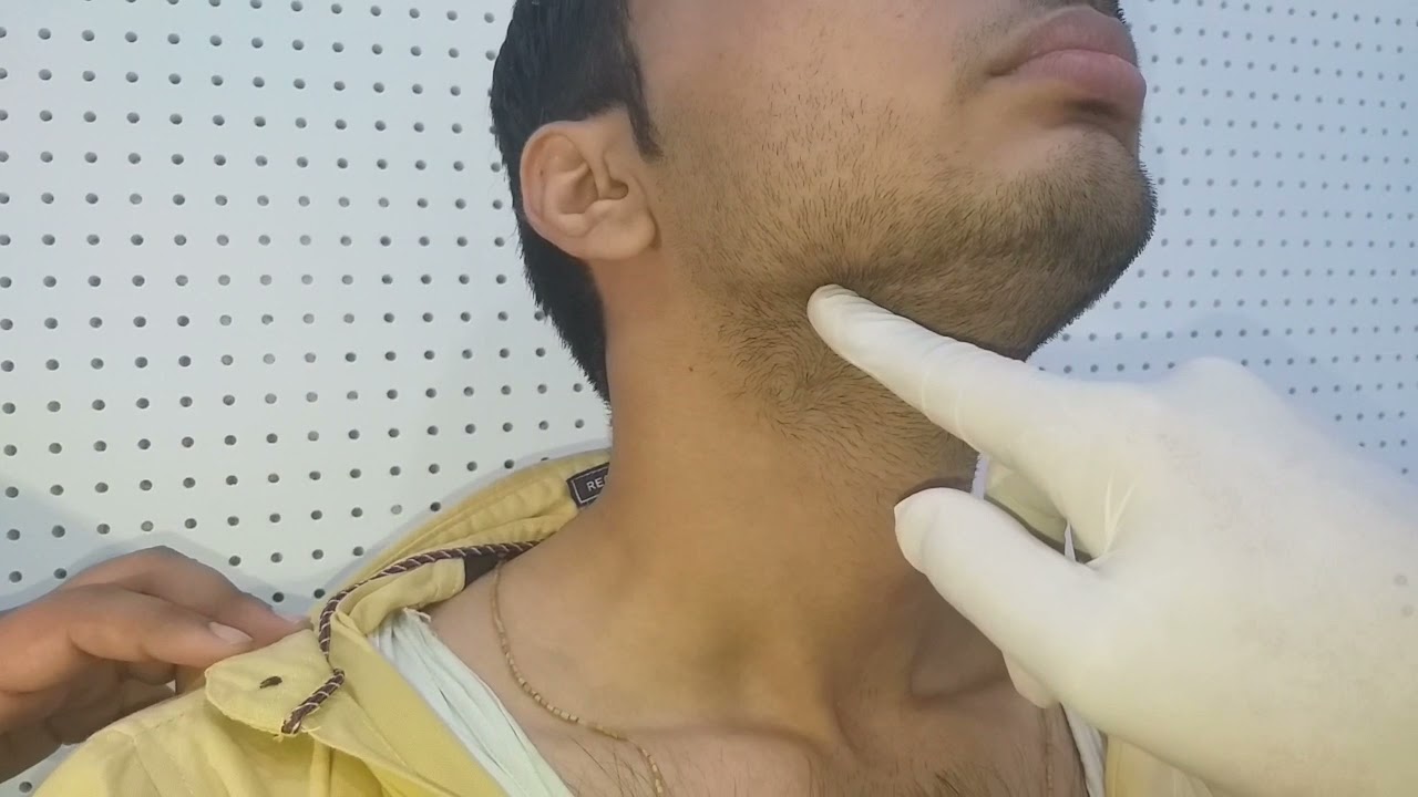 Neck Examination - Dr Mohan Bansal - Neck Triangles Lymph Nodes ...