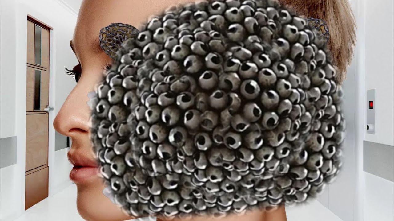 ASMR Trypophobia Remove And Maggots | Deep Cleaning and Animation ...