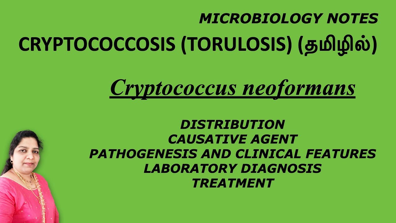 Cryptococcosis (Torulosis) / Cryptococcus neoformans - pathogenesis ...