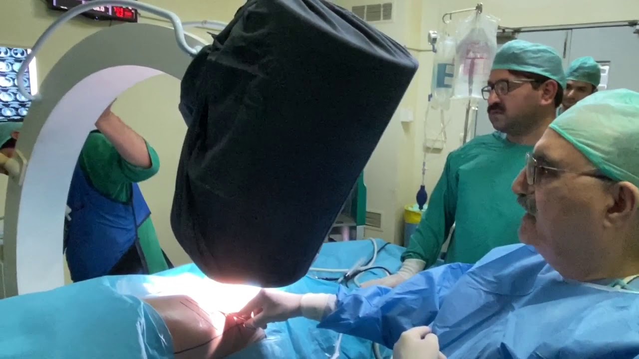 30yr left mini pcnl - YouTube