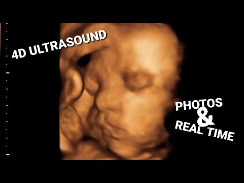 4D ULTRASOUND baby scan at 31 Weeks Pregnancy - YouTube