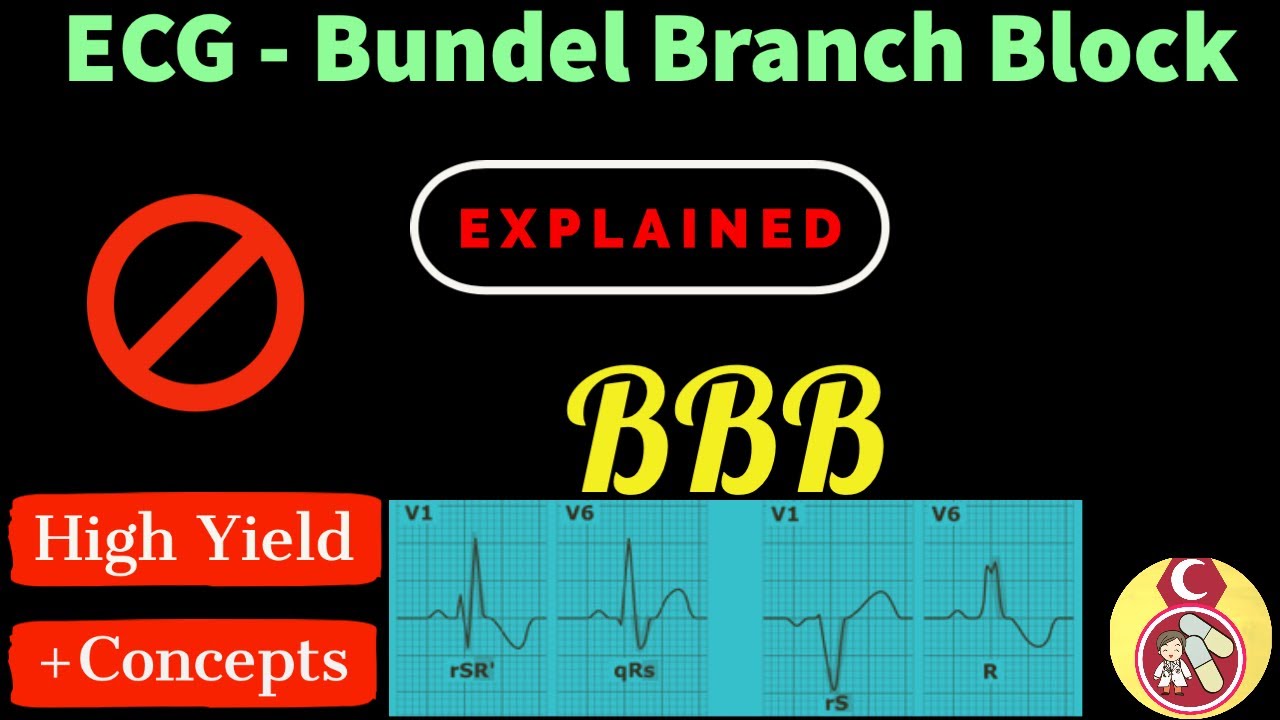 ECG Crash course - #11 Bundle Branch Block - BBB - YouTube