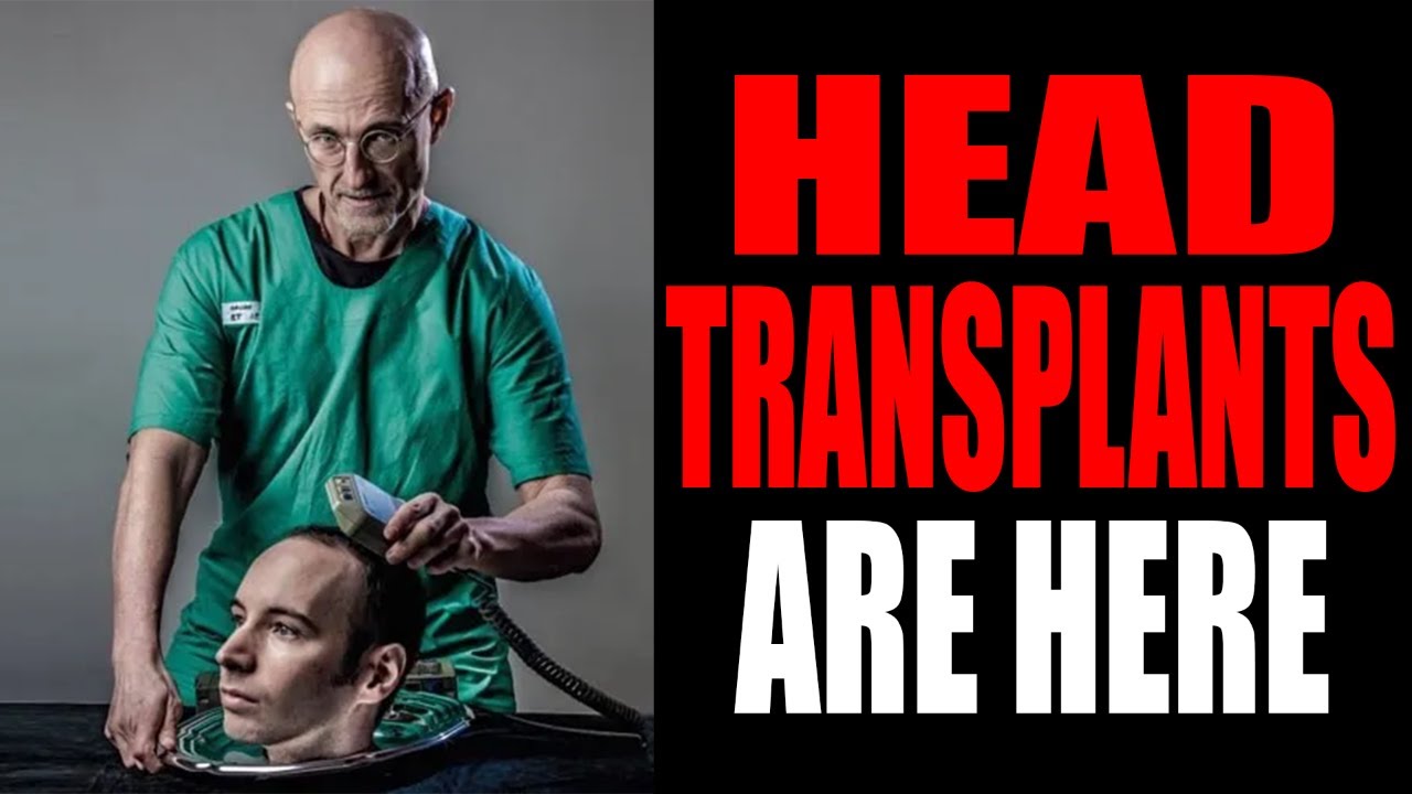 First Head Transplant Successfully Done On A Corpse & Futuristic ...