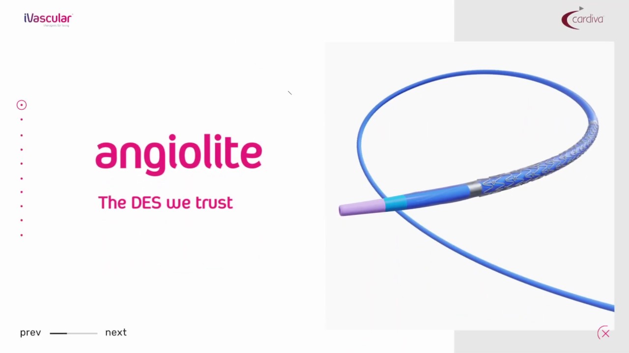 angiolite, óptima navegabilidad - YouTube