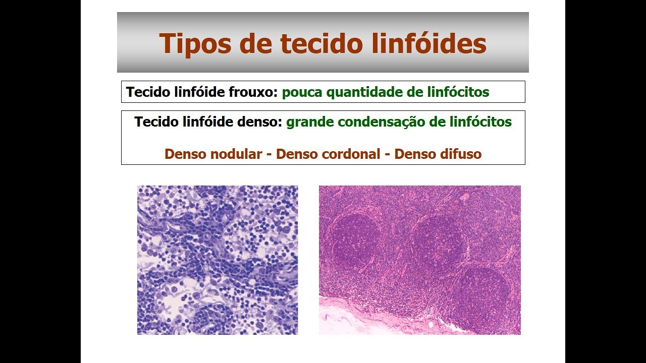 Histologia Do Tecido Linfoide Associado Ao Intestino PDF) Histologia
