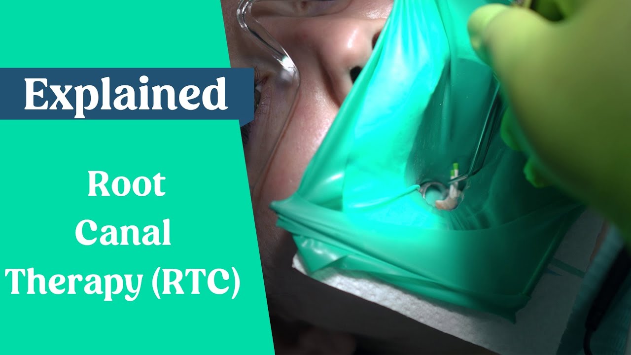 Root Canal Procedure (RCT) Explained - YouTube