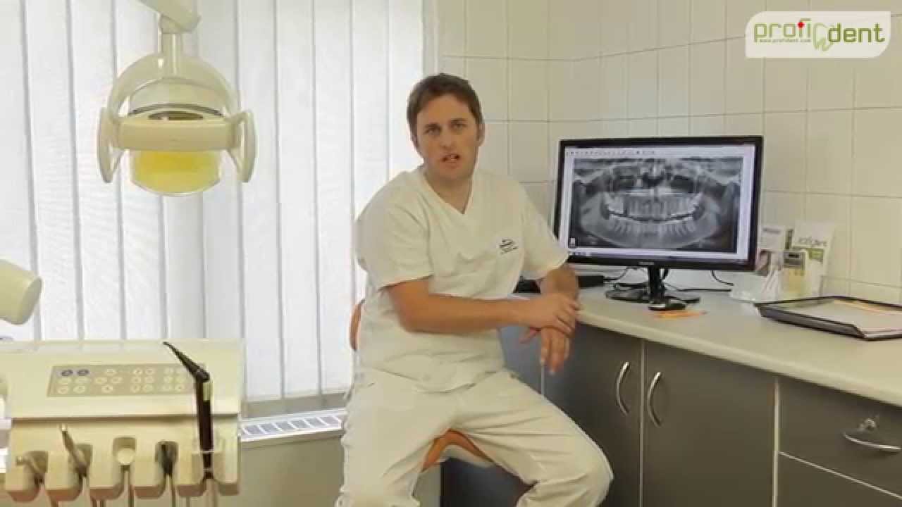 Profident - Az implantáció - YouTube