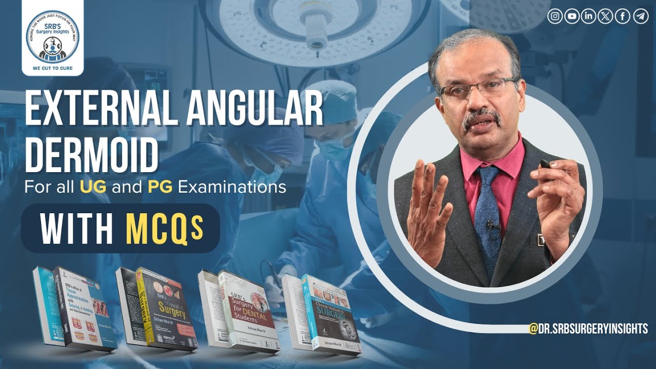 External Angular Dermoid by Dr. SRB | Dr. Srirama Bhat - YouTube