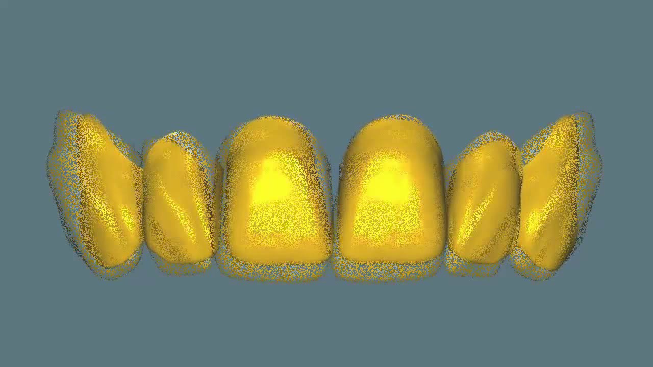 Exocad tooth library - YouTube