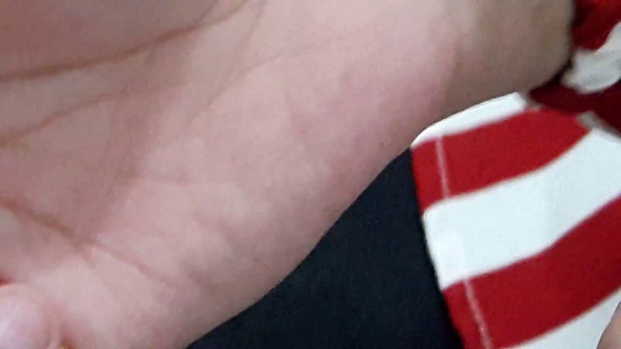 Nylon Fabric Allergy at Mattie Delgado blog