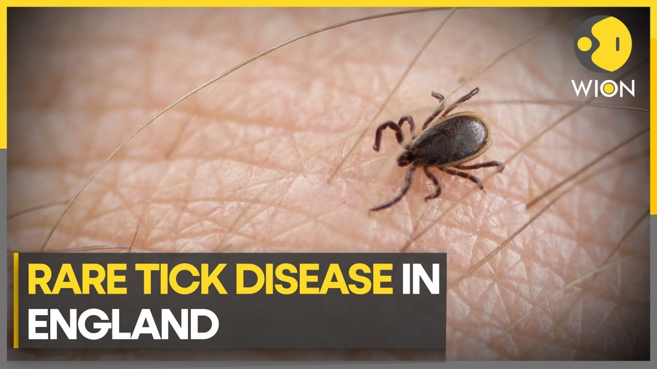 Rare encephalitis tick disease found in England | Latest English News ...