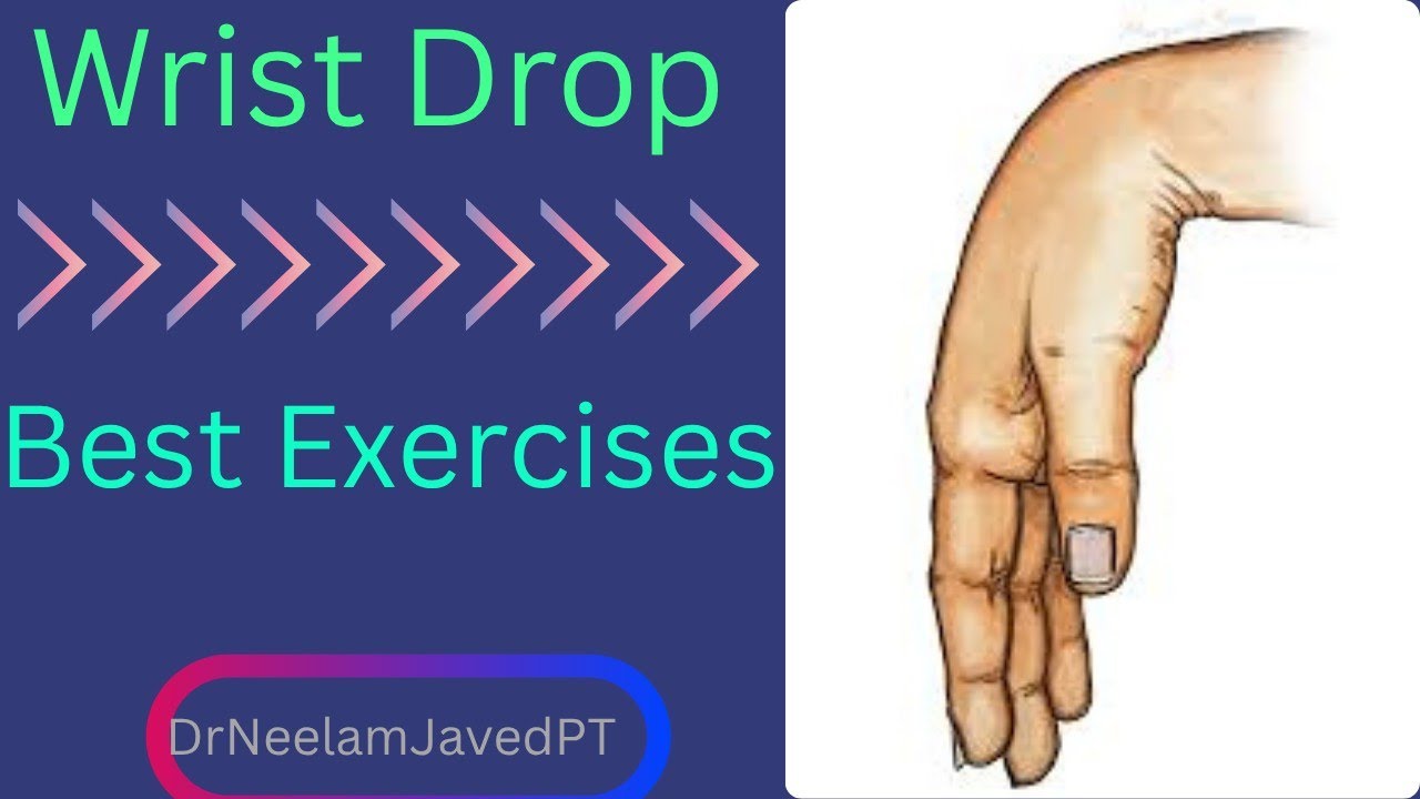 Wrist drop Best Exercises. #wristdrop #wriststrength #physiotherapy # ...