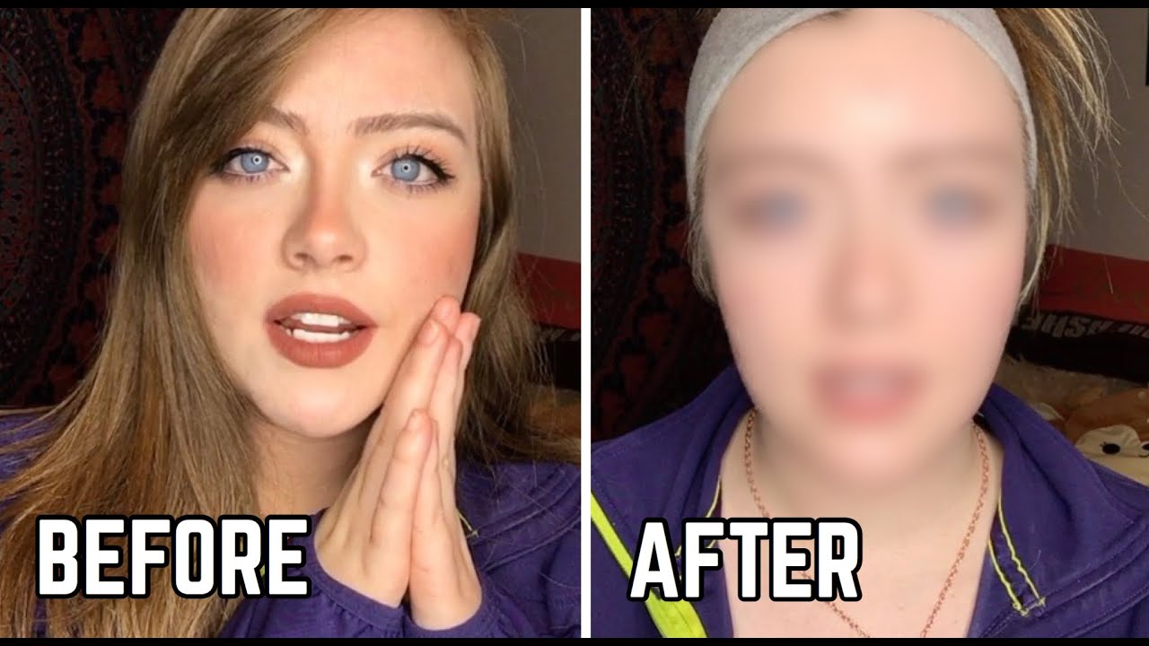 ASMR | Nightly Skincare Routine! FOR BAD ACNE *crinkling, whispering ...