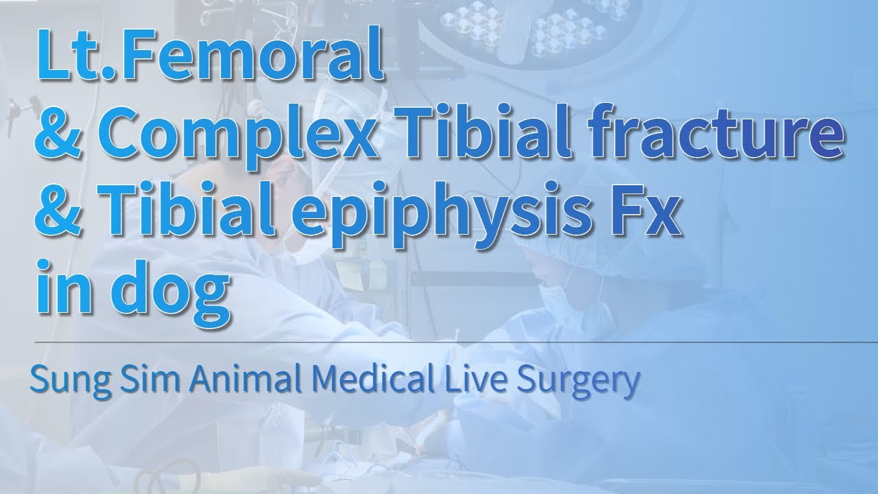 [Warning] Lt.Femoral&Complex Tibial fracture& Tibial epiphysis Fx in ...