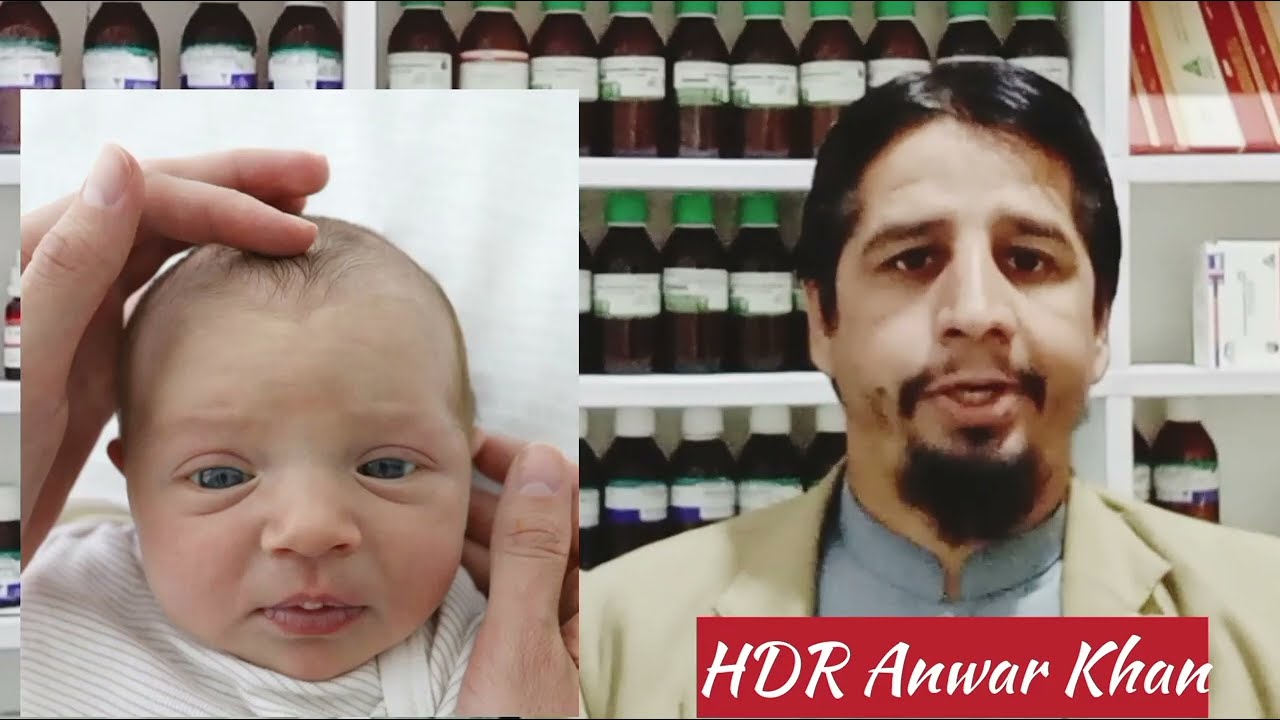 baby soft spot on head, newbornbaby front and Back Fontanelles.Homoeo ...