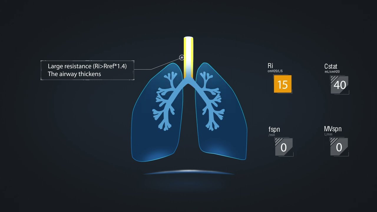 Mindray PulmoSight: Intuitive Dynamic Lung Feedback - YouTube
