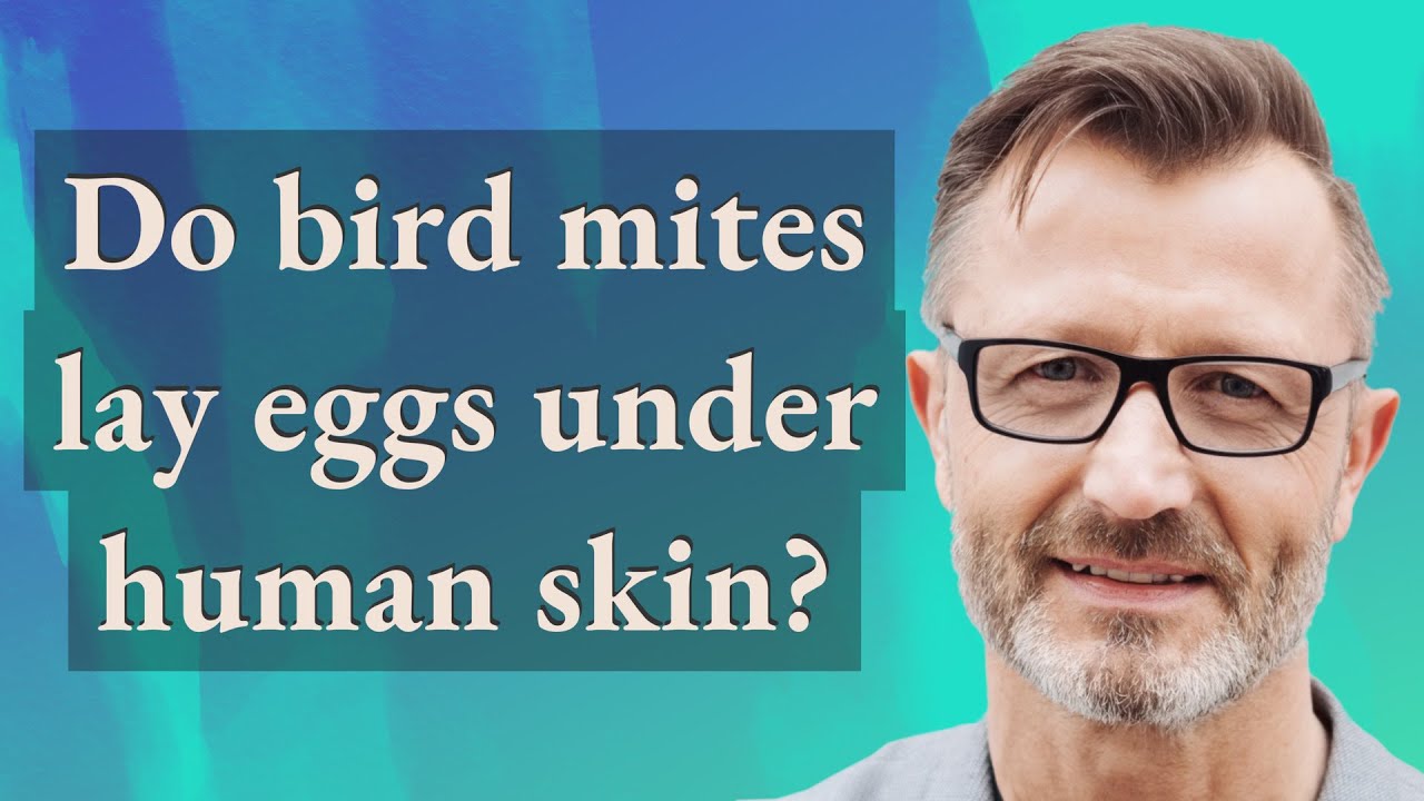Do bird mites lay eggs under human skin? - YouTube