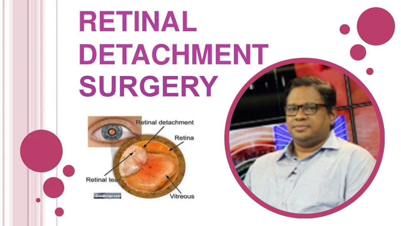 Retinal Detachment Surgery | PPV+MP+PFCl+EL+FAE+SOI | Dr Kousik ...