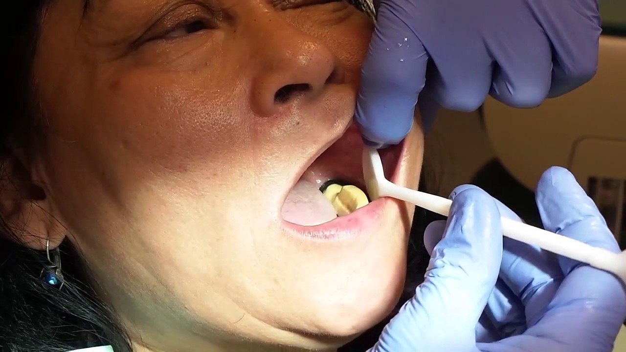 joint peripherique inferieur - YouTube