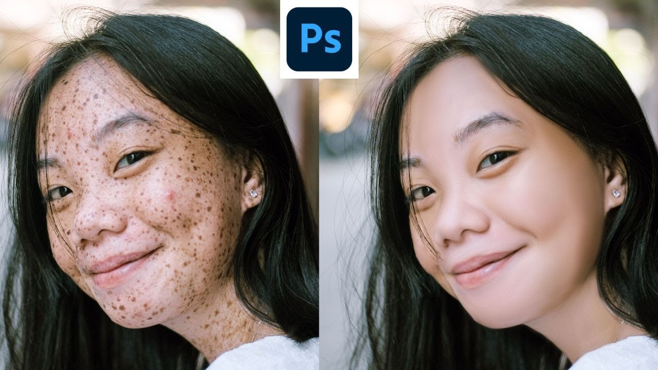 High End-Skin Remove Pimple & acne on face | Retouching Beginner ...