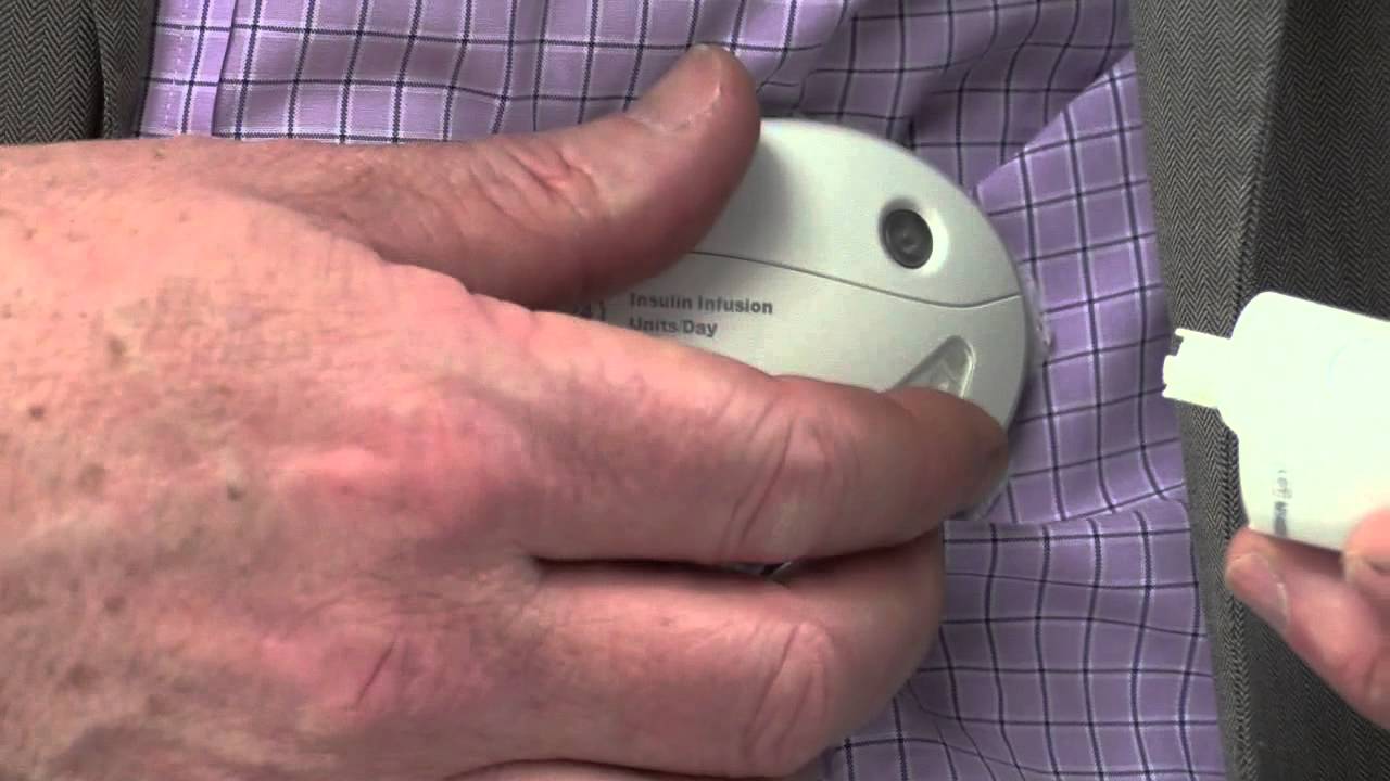 Marlborough Company Makes Wearable Insulin Delivery Device - YouTube