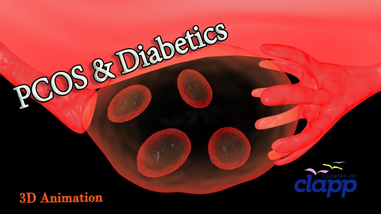 PCOS AND DIABETICS ( 3D Animation ) - YouTube