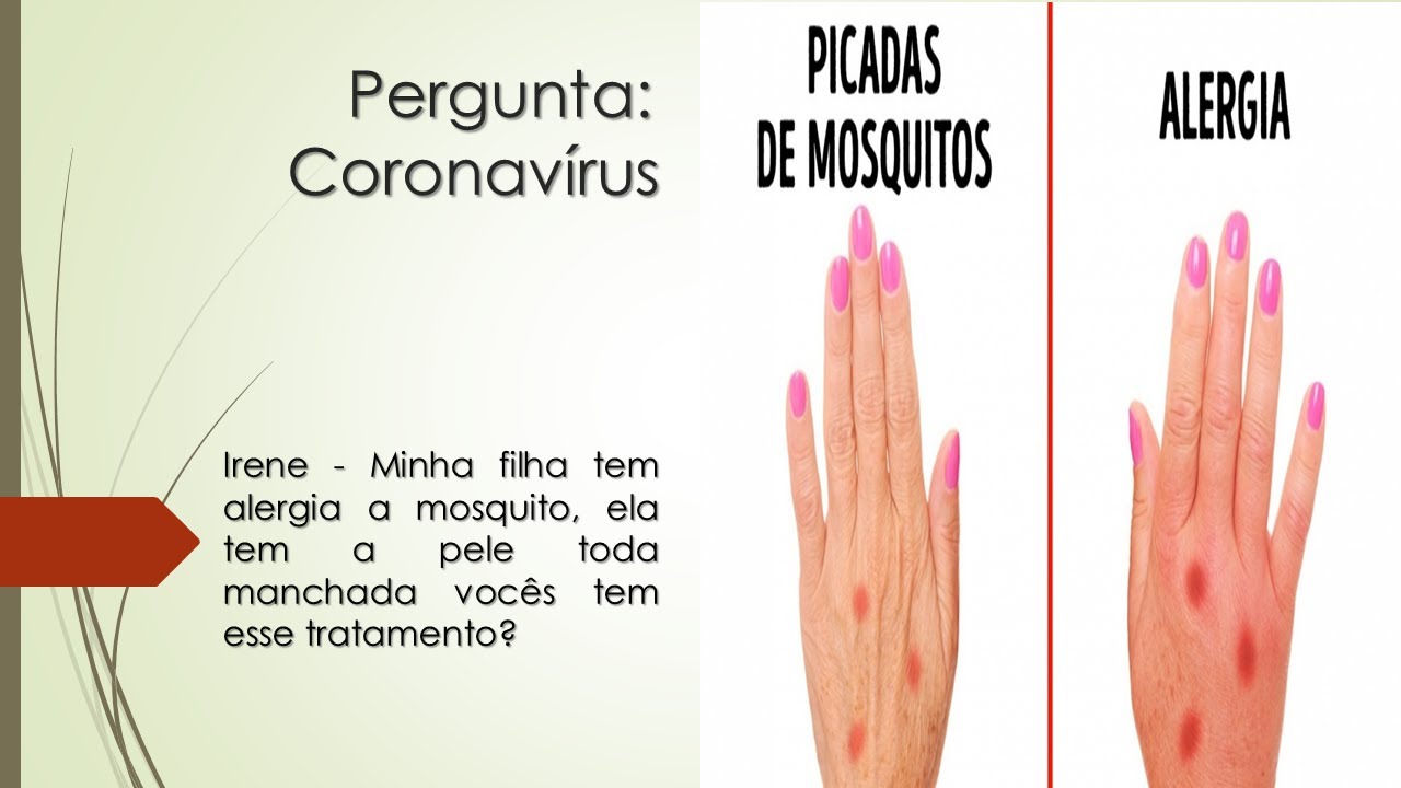 Alergia a Picada de Inseto | Minha filha tem Alergia a Mosquito | Qual ...