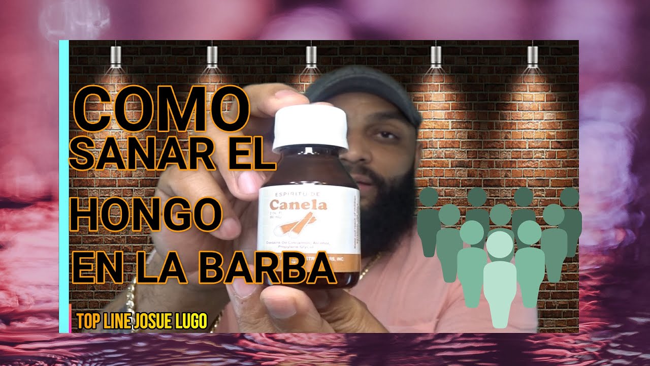 COMO SANAR EL HONGO EN LA BARBA - YouTube
