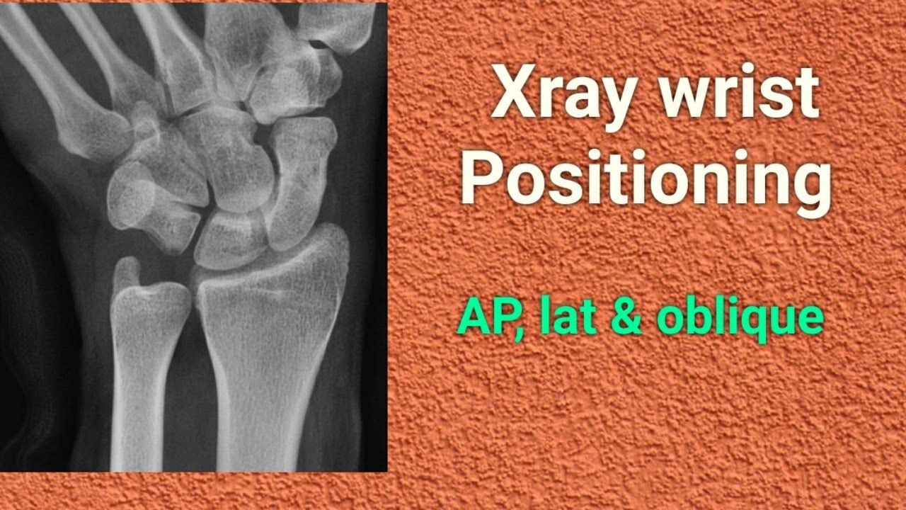 Wrist joint X-ray | Wrist PA view | Wrist Lateral view | Wrist Oblique ...