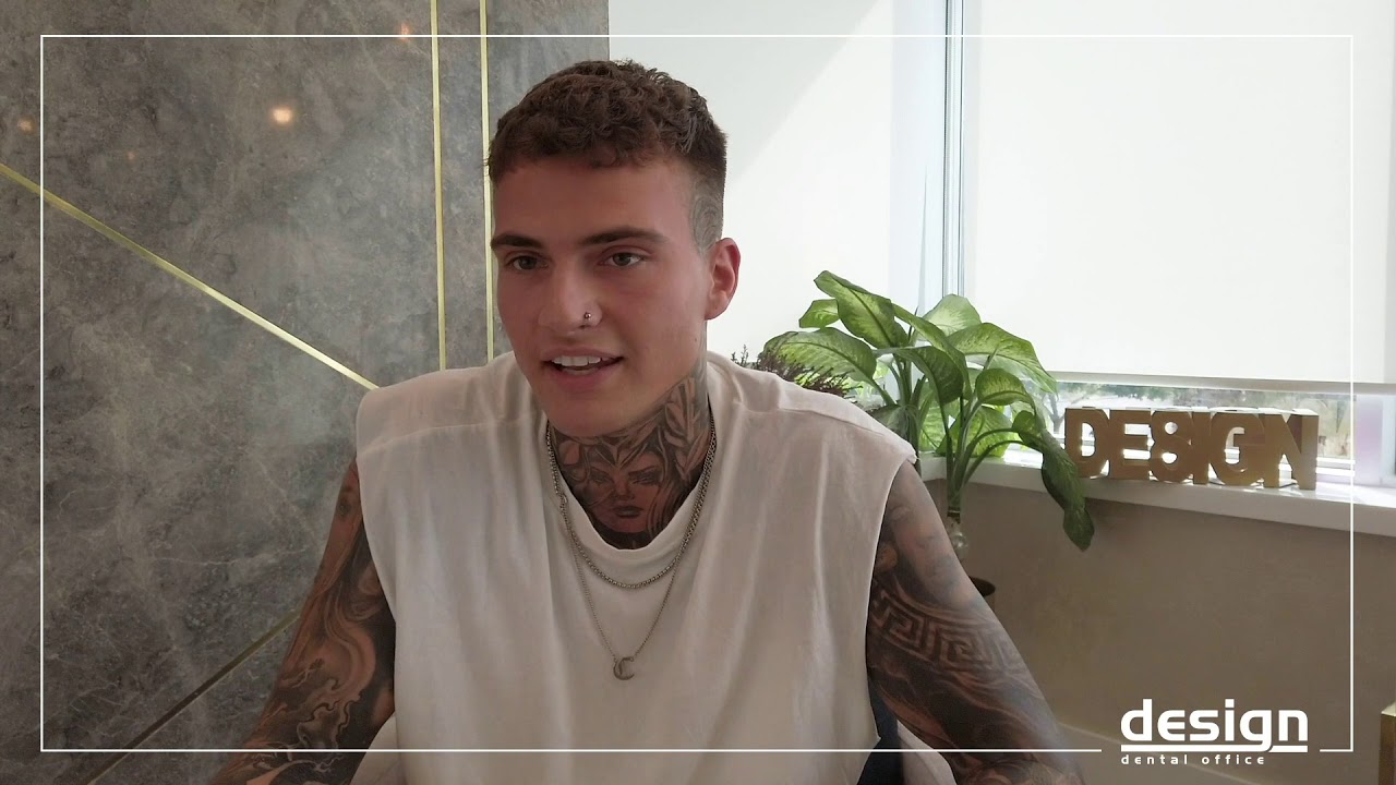 Charlie Edwardz's New Teeth in Turkey ( He got new teeth done in ...