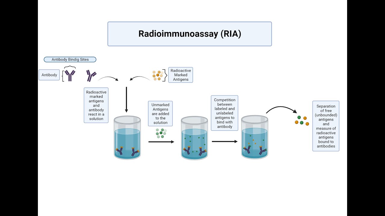 Application of Radioimmunoassay (RIA) In Diagnosis - YouTube