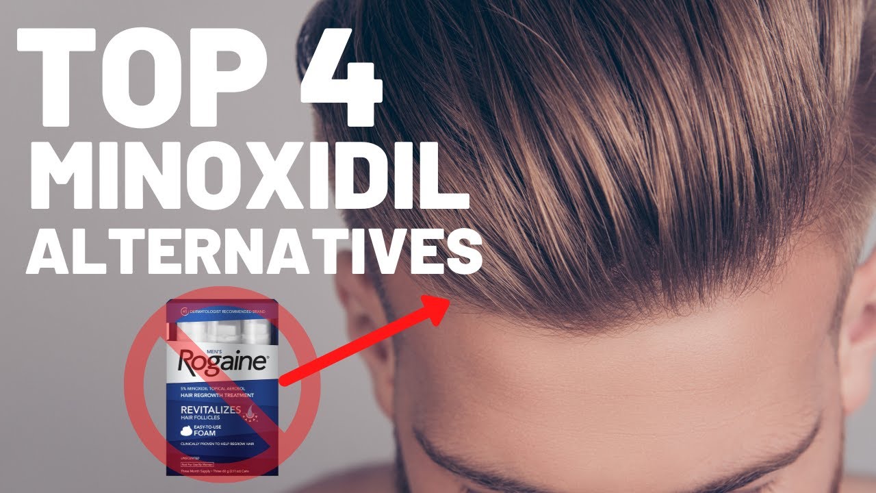 Top 4 Topical Alternatives to Minoxidil for Hair Loss - YouTube