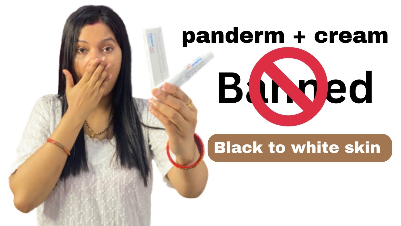 Panderm + cream BANNED ! अब ये क्रीम हमेशा के लिए बंद हो गई अब नहीं ...