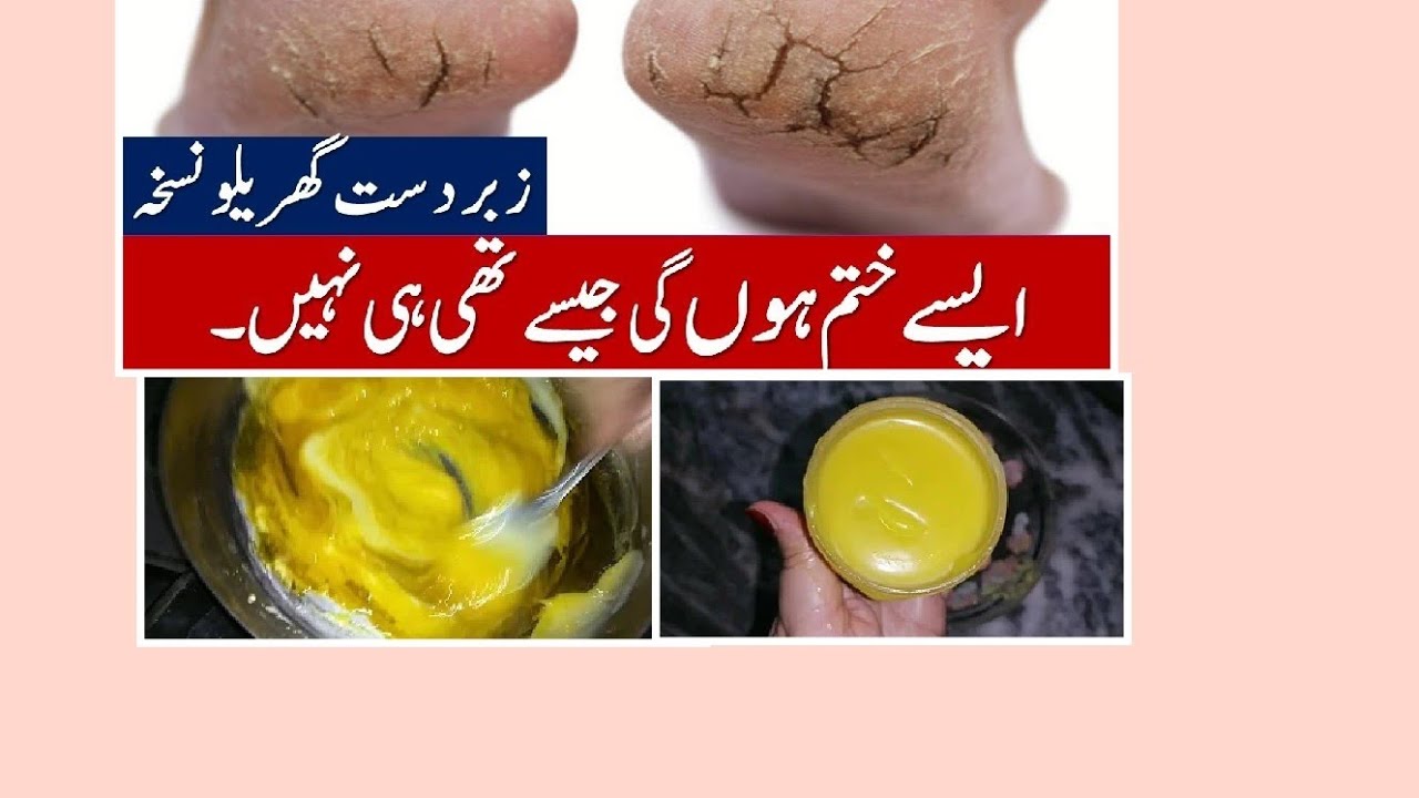 Crack heel repair solution at home|Candle wax + Mustard oil +Vaseline ...