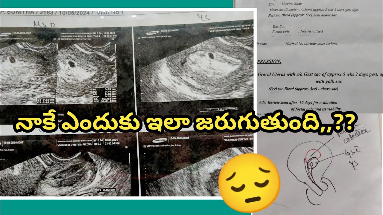 Pregnancy first scan details🤰 || Viability scan in pregnancy 👣 - YouTube