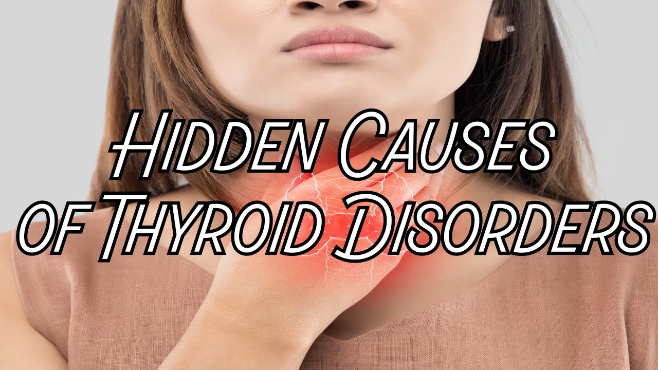 GET YOUR SPARK BACK! THE HIDDEN CAUSES OF THYROID DISORDERS - YouTube