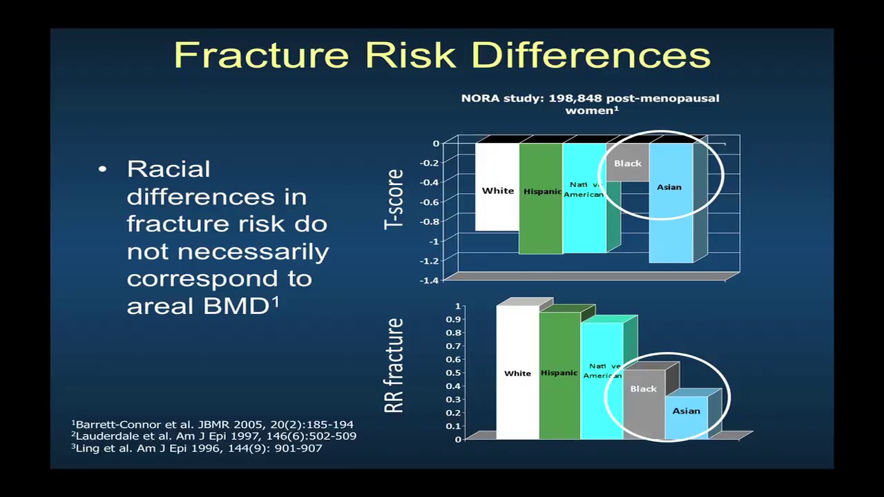 Racial Differences in Bone Density - Dr. Walker - YouTube