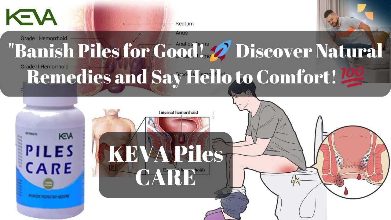 "Keva Piles Care – The Ultimate Ayurvedic Treatment for Hemorrhoids ...