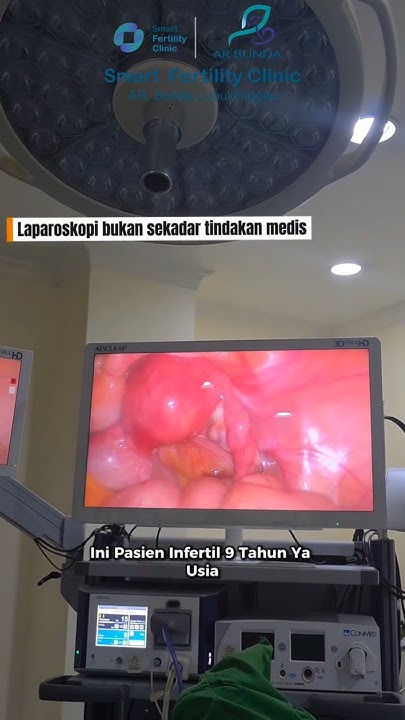 Operasi Laparoskopi, Ini Dia Prosesnya #pejuanggarisdua #infertility #bayitabung - YouTube