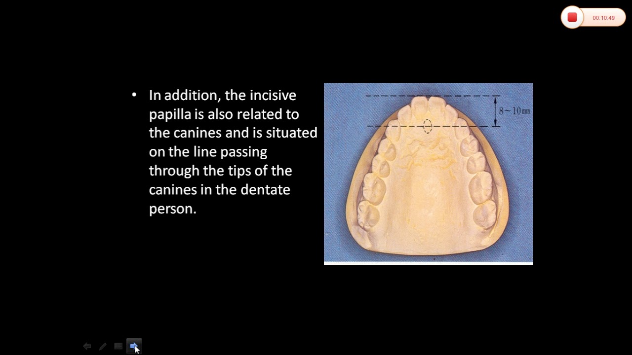 principles of Teeth arrangement/part1/Dr.K.A.Saranbabu/16-6-2020 - YouTube