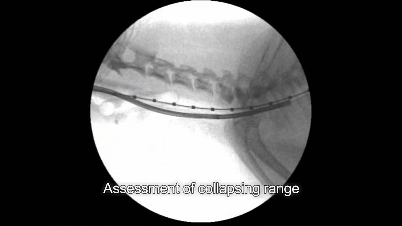 Veterinary Bronchoscopy#547, Grade4 Primary Tracheal Collapse ...