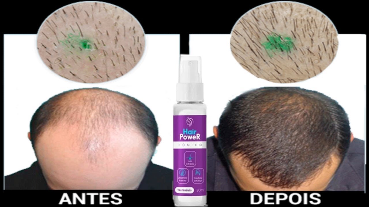 Hair Power Funciona? URGENTE!! é ? Hair Power Antes e Depois? Hair ...