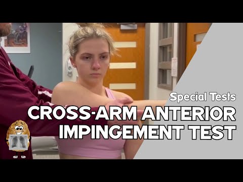 Cross-Arm (Horizontal Adduction) Anterior Impingement Test - YouTube